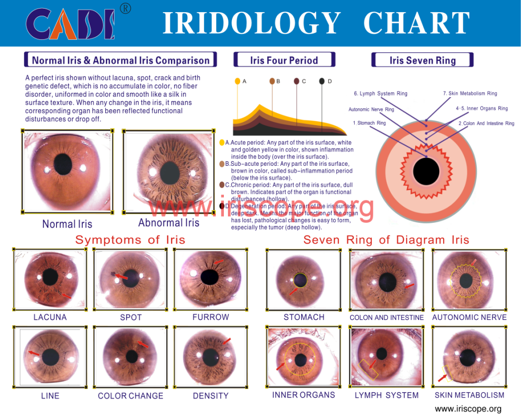 Iridology Chart: How To Read It? A Guide By MAIKONG – MAIKONG Iridology ...