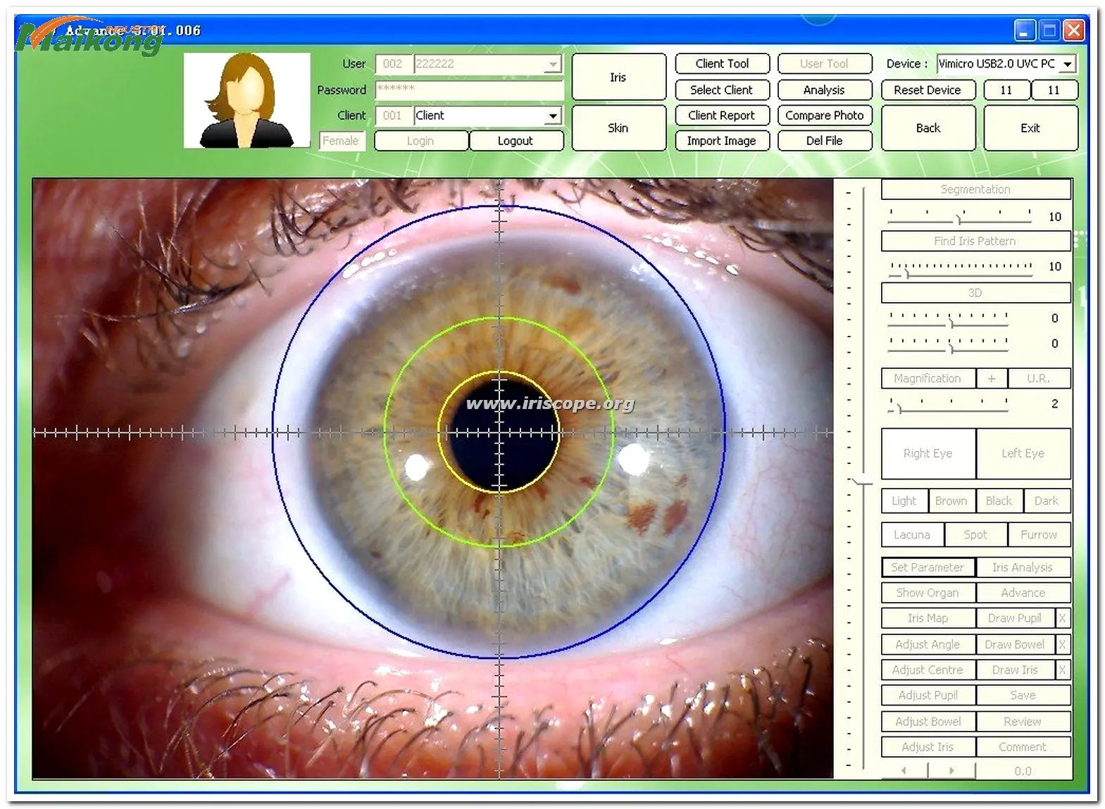 Exploring The Mobile Aspects Iriscope By MAIKONG: A Comprehensive Guide ...